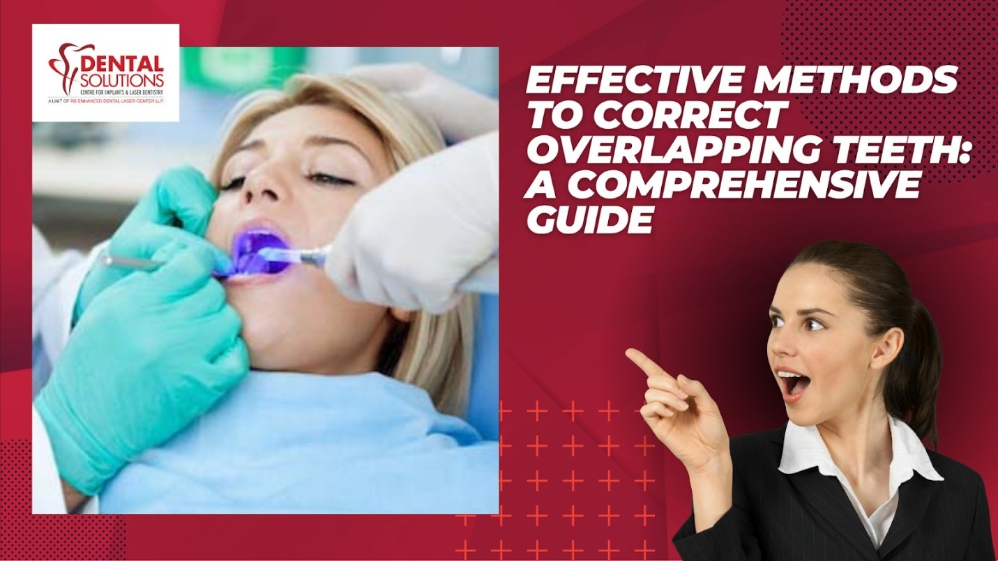 Correct Overlapping Teeth: Effective Methods & Guide